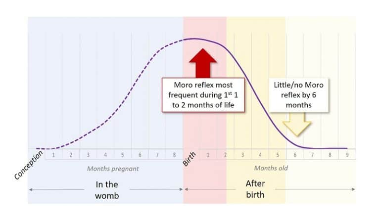 The Moro Reflex Uncovered: Everything You Need To Know!